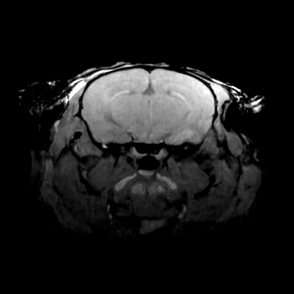 nanoScan® MRI 3T/7T - 美迪索医学影像系统提供专业分子影像解决方案 - nanoScan PET/MRI 3T 7T