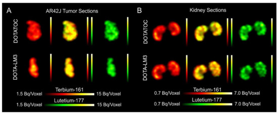 双同位素SPECT成像：借助Mediso美迪索nanoScan® SPECT/CT同时可视化161T